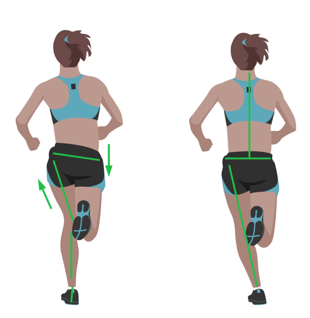 Sports Injury Bulletin - Anatomy - Hip weakness and shin splints: a ...
